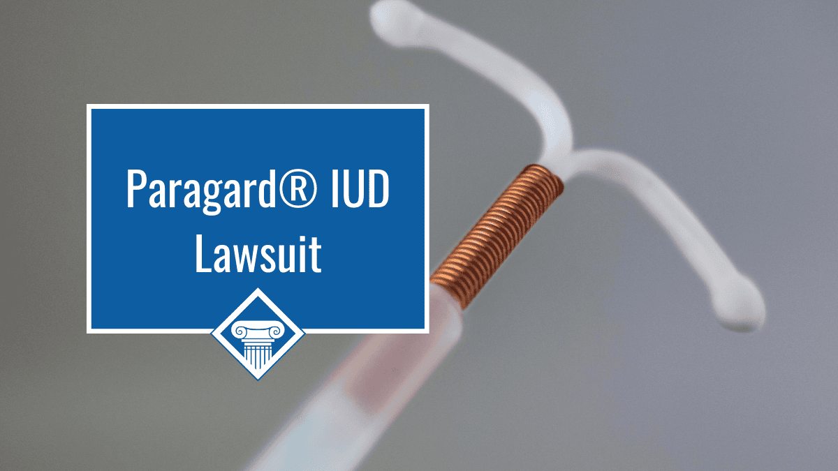 Paragard IUD Lawsuit